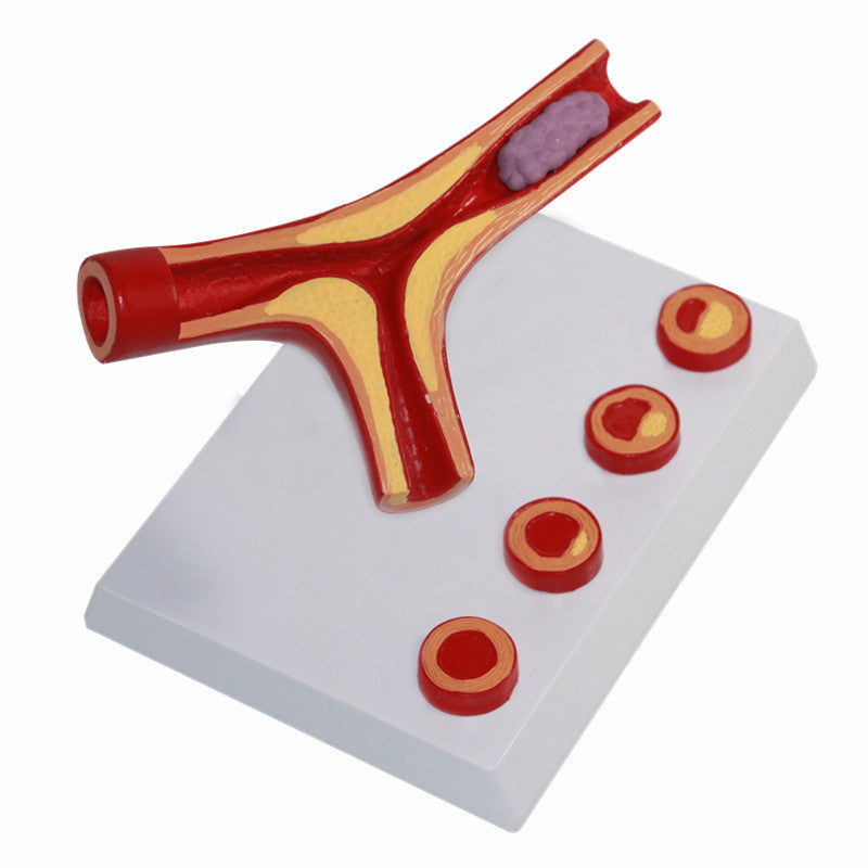 Creative Human Vascular Enlargement Model – Sociable Weaver Nest